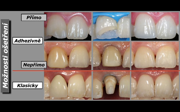 Protetika I. :: Daniel Svoboda